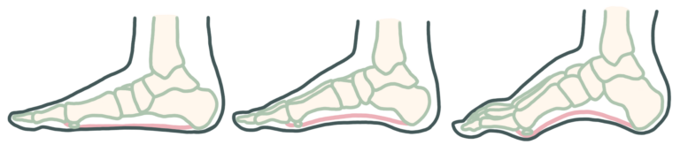 The Dancer’s Guide to Foot Arches - Baseline Dance